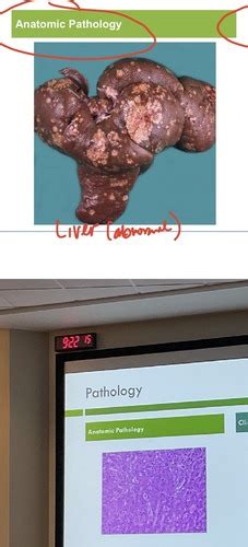 lec 1 intro lec 2 cell degeneration and death cell biology ad types of injuries zach