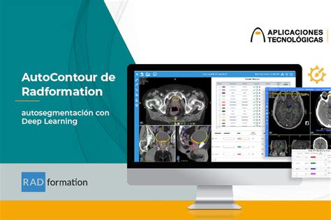 Autocontour De Radformation Autosegmentación Con Deep Learning Sefm