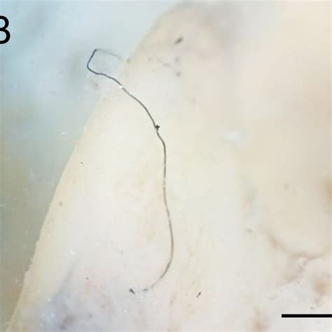 Examples Of Microlitter Items Retrieved From The Digestive Tract Of Download Scientific Diagram