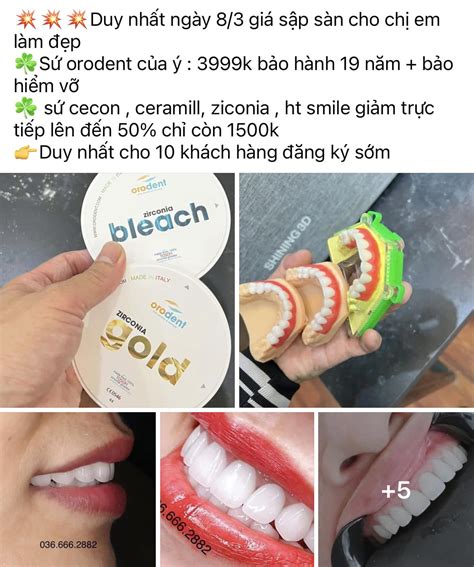 Răng Hà Nội Tô Hồ An Mỹ Răng Hà Nội Tô Hồ An Mỹ