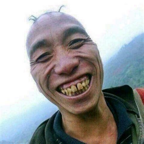 T Ng H P Nh Ng B C Nh C I H I H C Nh T V I Nh C I H I H C V Chia S Mi N Ph