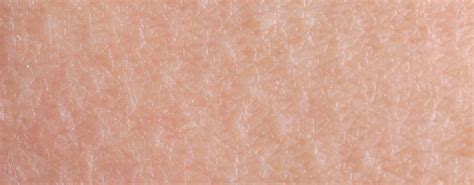 Ablative Vs Non Ablative Laser Treatment Whats The Difference