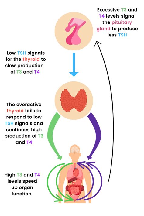 What Do High And Low Tsh Levels Mean Thyroid Levels Thyroid Disorders
