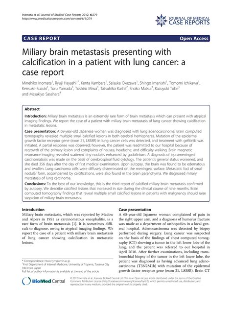 Solution Miliary Brain Metastasis Presenting With Calcification In A Patient With Lung Cancer A