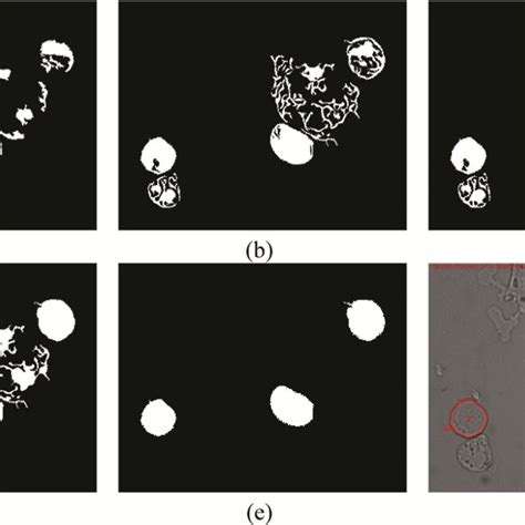 Cells Segmentation Steps On The Image Given In Fig 1 B A Initial