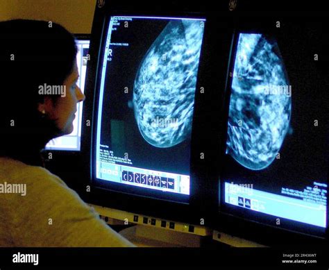 File Photo Dated 150606 Of A Consultant Analysing A Mammogram As Scientists Have Developed An