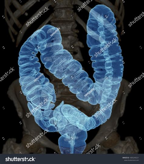 Ct Colonography Ct Scan Colon 3d Stock Illustration 1685249221 Shutterstock
