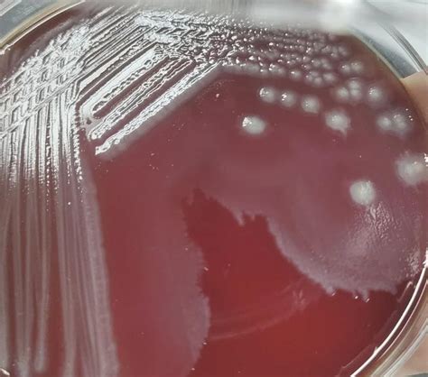 微生物笔记：变形杆菌