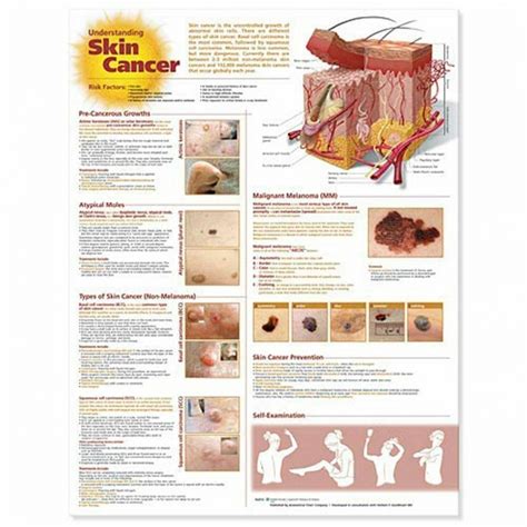 Understanding Skin Cancer Chart 52x70cm With Special Rigid Lamination