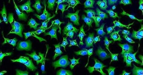 Drug Targeting Rna Modifications Shows Promise For Treating Neuroblastoma Biological Sciences