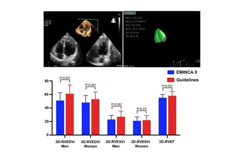 Study Reports Normal Values Of 3d Echocardiographic Right Ventricular