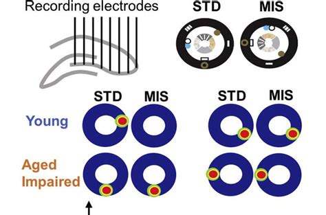 Neuroscientists Find Brain Mechanism Tied To Age Related Memory Loss