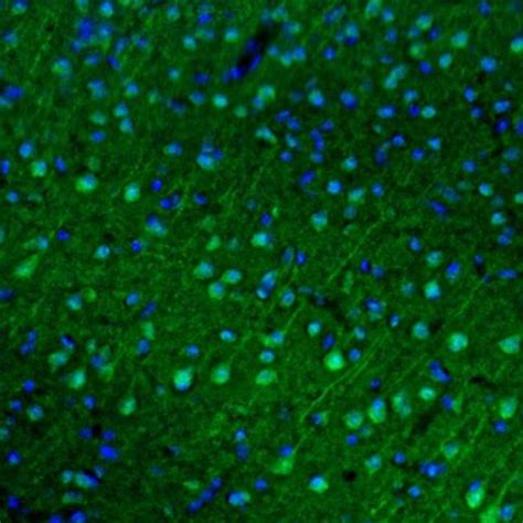 Rabbit Polyclonal Anti Foxo1 Antibody Buy For Research Highly Specific Rigorously Validated