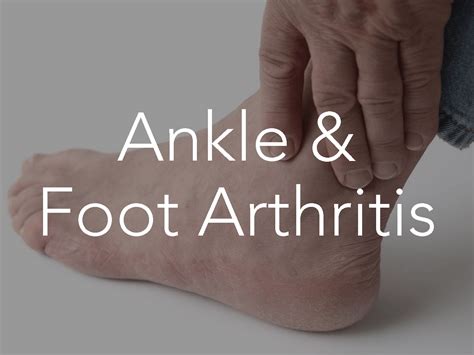 Frisco Ankle And Foot Arthritis Frisco Foot And Ankle Specialists