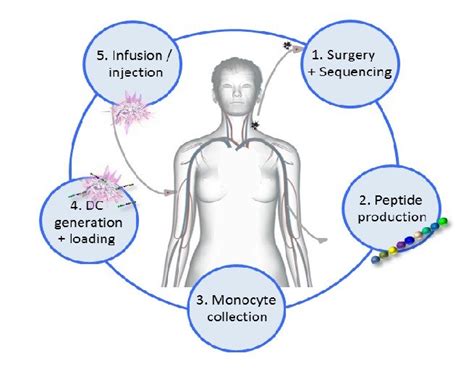 Epitope Based Dendritic Cell Vaccine Immature Dendritic Cells Are
