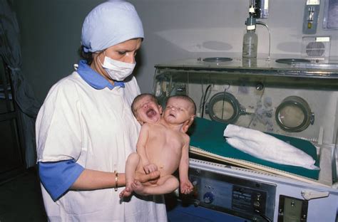 عکسی از یک نوزاد دو سر در ۸ آذر ۱۳۶۶ در تهران طرفداری