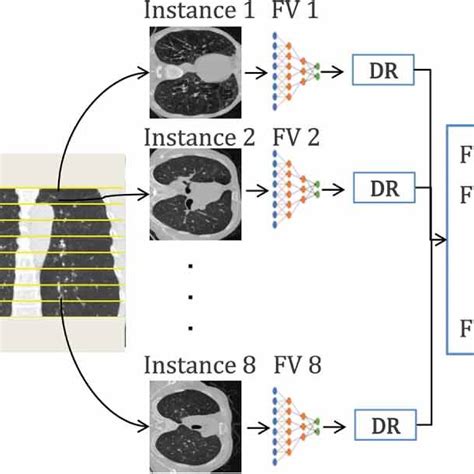 The Overview Of The Proposed Deep CNN Transferred Multiple Instance
