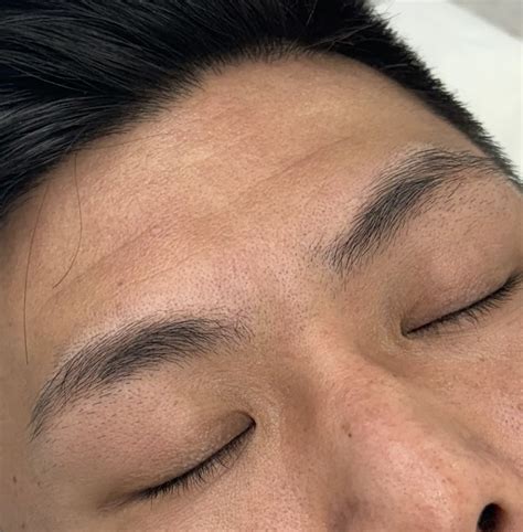 Why Do My Eyebrows Grow Back So Fast