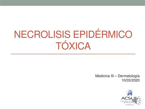 Necrolosis Epidérmico Tóxica Héctor Dávila Guevara Udocz