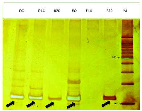 Electrophoresis Visualization Of The Amelogenin Loci M ¼ Base Pair Download Scientific Diagram