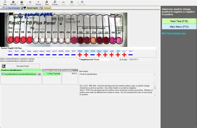 Biomic V3 Microbiology System Remel Rapid Reading Giles Scientific Usa