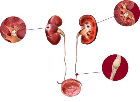 Js정의원 성신여대 한성대입구역 피부과 제모 보톡스 문신제거