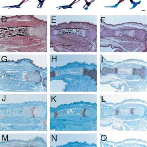 Runx3 Expression In Runx3 − Mice And Skeletal Development In Runx3 Download Scientific