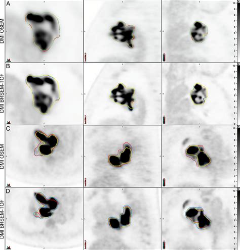 Examples Of Lower And Higher Inter Observer And Intra Observer Download Scientific Diagram