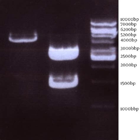 2 Biosynthesis Of Preproinsulin And Its Subsequent Conversion To