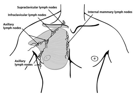 Learnoncology