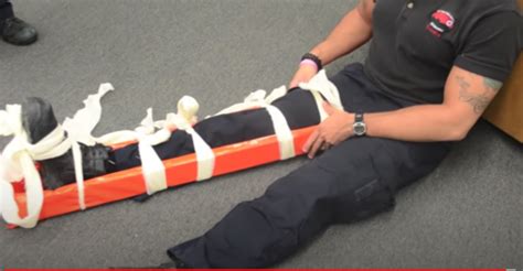 Emt Splints And Trauma Flashcards Quizlet