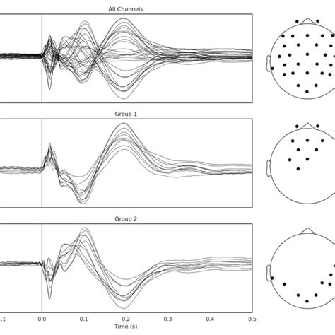 A Evoked Potentials Time Locked To Onset Of Tms Pulse B And C Download Scientific Diagram