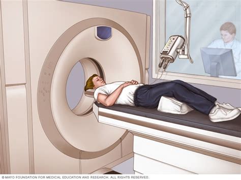 CT Scan Mayo Clinic