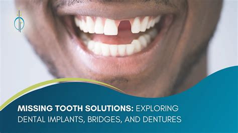 Missing Tooth Solutions In Deerfield Beach Implants And Dentures Blog