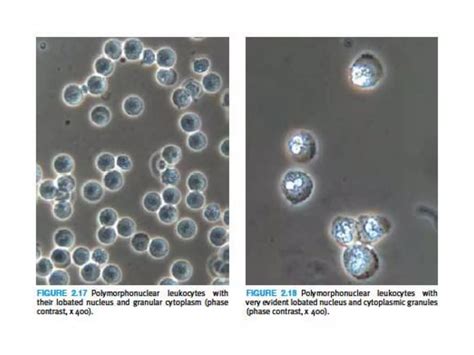 Urine Microscopy Ppt