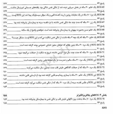 خرید کتاب تفسیر 150 نوار Ecg الکتروکاردیوگرافی 2019 کتابفروشی آنلاین جامعه‌نگر
