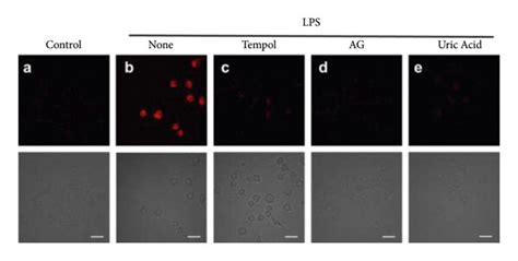 An Ultrafast Fluorescent Probe For The Detection Of Peroxynitrite In Living Cells Wang 2022