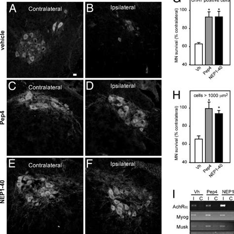 Pep4 And Nep1 40 Prevent Motor Neuron Death After Sciatic Nerve Axotomy Download Scientific