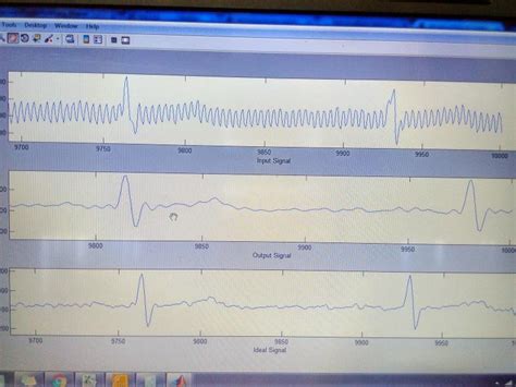 Akshay Bhavsar On Linkedin Power Line Noise Filter For Ecg Signal