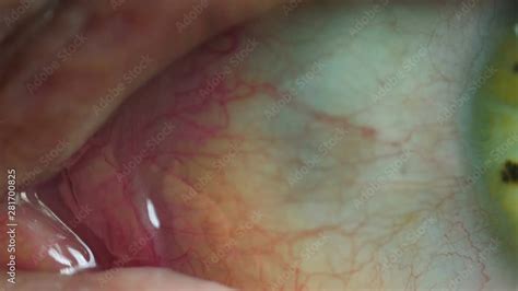 Lacrimal Caruncle And Tear Duct In Human Eye Macro Close Up Vídeo De Stock Adobe Stock