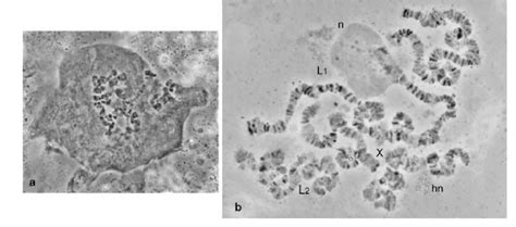 A Pupal Trichogen Cell Of A Scutellar Bristle Of Glossina Pallidipes