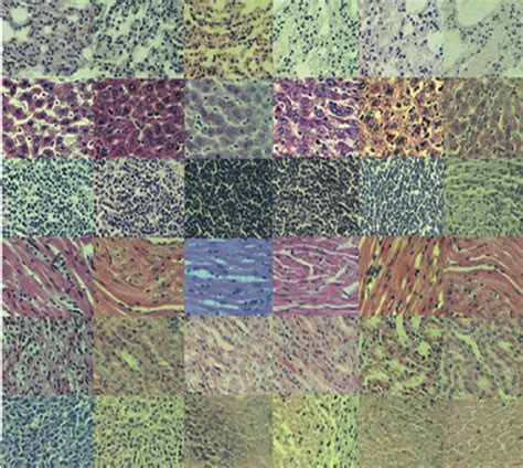 Average Tumor Volume In A S180 Mouse Model Of Treatment Without A Download Scientific