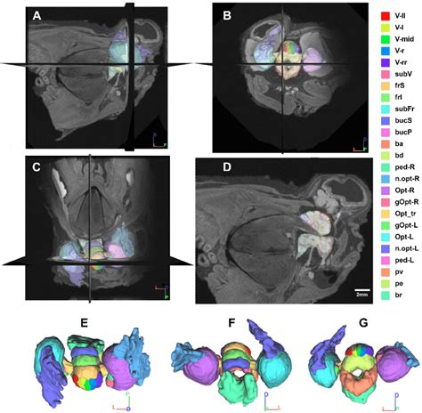 Three Dimensional Anatomic Annotation A~c Three Slices From Download Scientific Diagram