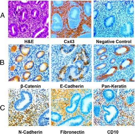 A C Histology And Ihc Of Proliferative Phase Endometrium Biopsies Of Download Scientific