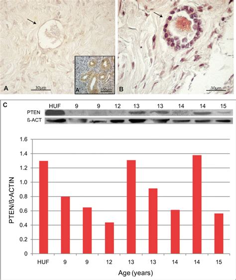 Expression Of Pten In Pubertal Human Ovary A Illustrative Primordial