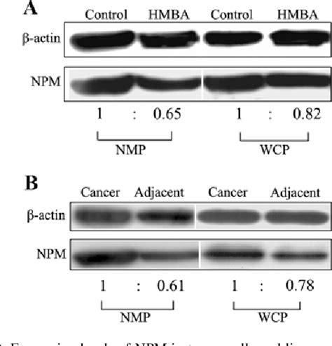 Figure 2 From Regulatory Role Of Nucleophosmin During The Differentiation Of Human Liver Cancer