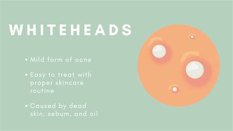 The 8 Types Of Acne And How To Treat Them Goodglow
