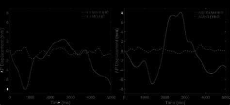 Grand Mean Of Cop Medial Lateral Displacement Mm Of Td Adults Left Download Scientific