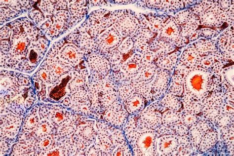 Thyroid Tissue Stock Image Image Of Microscopy Magnifying 196730717