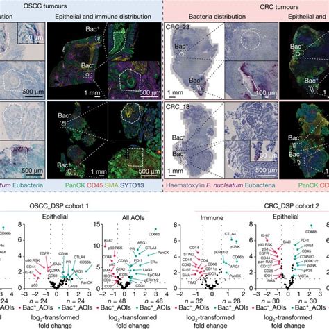 Assessing The Spatial Distribution Of Intratumoral Bacteria Throughout Download Scientific